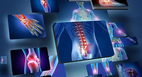 Selective Nerve Root Blocks Specialized Pain Management