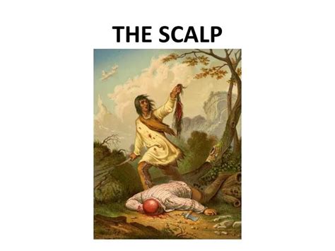 PPT THE SCALP PowerPoint Presentation Free Download ID 2637832