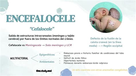 Neurología Udocz