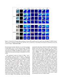 Industrial Anomaly Detection With Domain Shift A Real World Dataset And Masked Multi Scale
