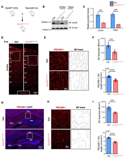 Reduced Pecam 1⁺ Vessels In Vps35neurod6 Cortex And Hippocampus A Download Scientific