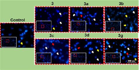 Dapi Stained Cells After Treatment With The Tetraalkynylated Anthracene Download Scientific