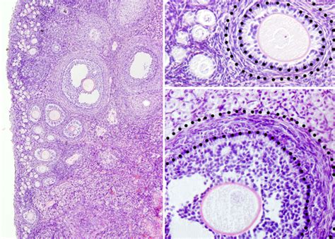 Zona Pellucida Histology