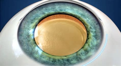 Aras Ai Lab Ai And Vr Medical Robotics