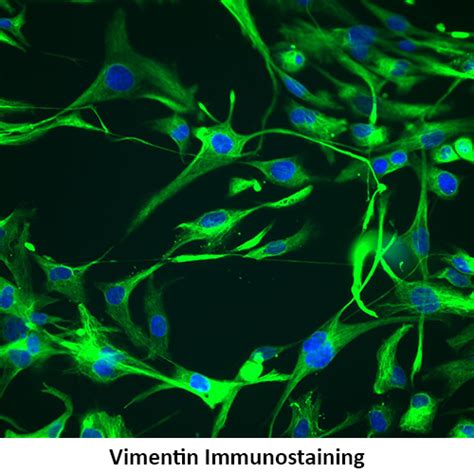 Immortalized Human Synoviocytes Innoprot Immortalized Primary Cells