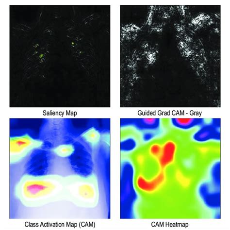 Visualizations Shown By Using Different Saliency Maps That Provide Download Scientific Diagram