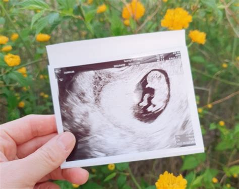 다시시작된난임여행 임밍아웃 임신9주와 임신 11주 증상 및 초음파사진1차기형아검사 네이버 블로그