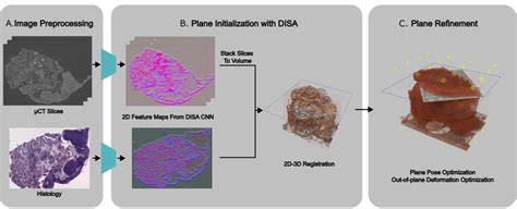 논문 리뷰 2d 3d Deformable Image Registration Of Histology Slide And