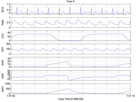 Case 5 Waveform Plots 10 Second Plots