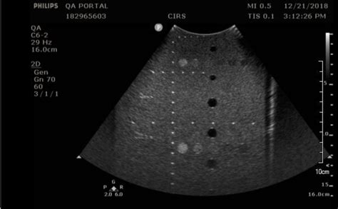 General Purpose Ultrasound Phantom CIRS Product Support