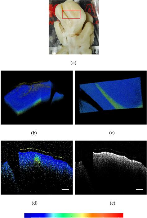 Figure 2 From Polarization Sensitive Optical Coherence Tomography For