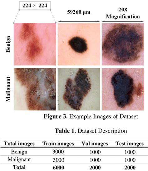 Figure 3 From Skin Cancer Segmentation And Classification Using Vision