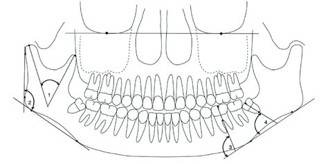 Linear Measurements Download Scientific Diagram