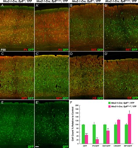 Cortical Interneurons Are Reduced In Nkx2 1 Cre Sp9 Flacz Rosa Yfp Download Scientific