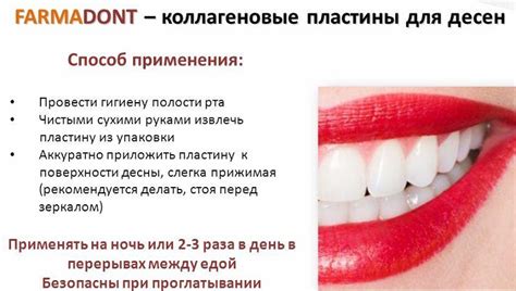 Коллагеновые пластины для десен Фармадонт (Farmadont): состав ...