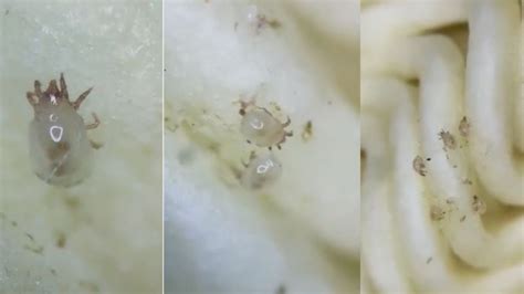 Insects Found Inside Noodles Video Al Bawaba