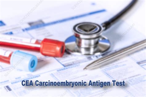 Carcinoembryonic Antigen Test Conceptual Image Stock Image F037