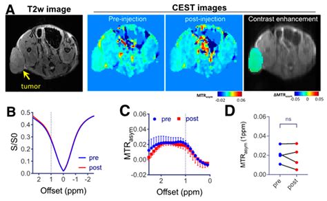 Theranostic Cancer Treatment Using Lentinan Coated Selenium Nanoparticles And Label Free Cest Mri