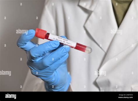Laboratory Blood Sample Corona Virus Laboratories Blood Samples