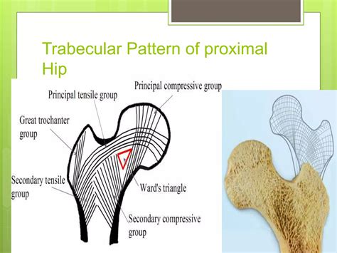 Nof Fracture Pptx