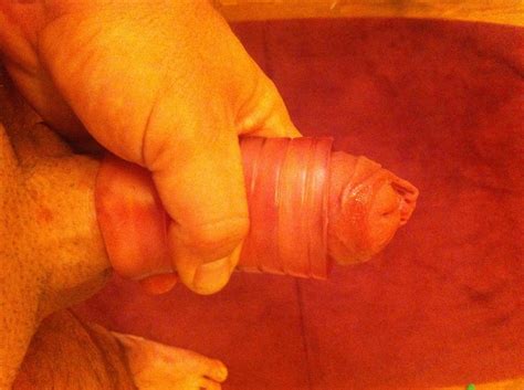 My Uncut Cock Xnxx Adult Forum