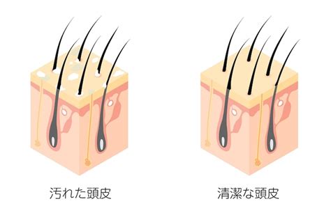 Premium Vector Diagrammatic Illustration Of A Cross Section Of A