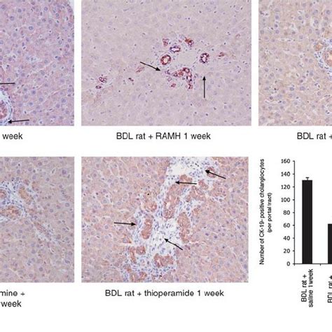 Measurement Of The Number Of Pcna Positive Cholangiocytes In Liver Measurement Of The Number Of Pcna Positive Cholangiocytes In Liver
