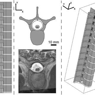 Finite Element Model Of The Spine And Spinal Cord Sagittal Left Download Scientific Diagram
