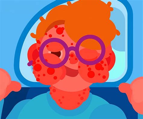 The Best Allergies On The Awesomer