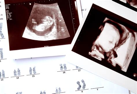 Sequential Tests In Pregnancy Process Accuracy And Results