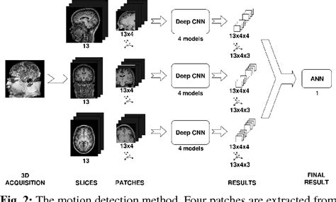 Figure 2 From Automatic Detection Of Motion Artifacts On Mri Using Deep Cnn Semantic Scholar