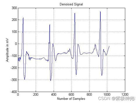 【脑电信号】基于matlab小波变换dwt脑电信号ecg去噪【含matlab源码 1622期】 wx610cd8661bd33的技术博客