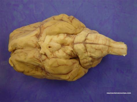 Brain Biopsyc Diagram Quizlet