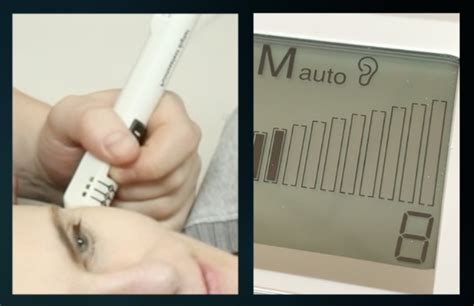 Measurement Of Electrodermal Activity For Improved Treatment Insight Canadian Institute Of