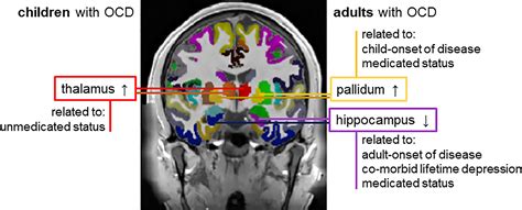 Ocd Brain Mri