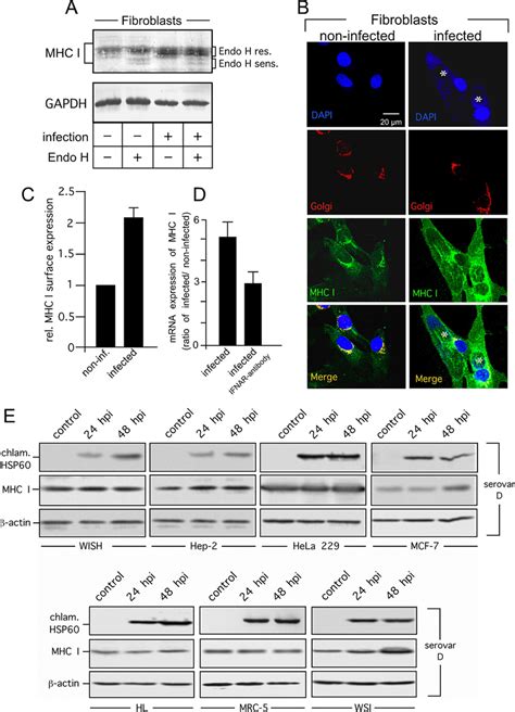 Mhc I Expression And Surface Presentation In C Trachomatis Serovar
