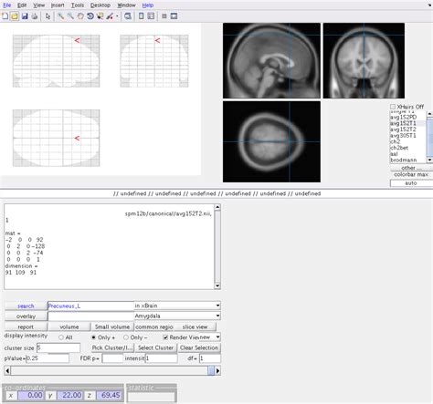 Creating A 3d Wireframe Cortical Model From Mni Brain Template With Matlab Using Myrobustcrust