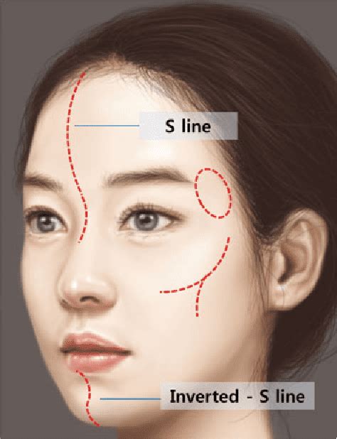 The Art And Science Of Filler Injection Based On Clinical Anatomy And The Pinch Technique