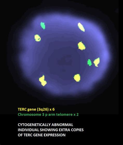 Terc Fish — Omnipathology