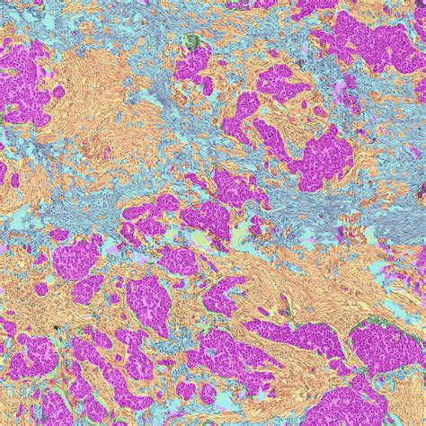 github deepathology fseg unsupervised semantic segmentation for