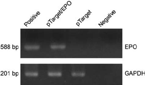 Rt Pcr Gene Expression Analyses Of Transfected Hela Cells The Upper Download Scientific