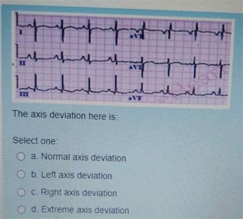 Solved 144 لہسلسلہ اساس لیلی لے لم لم The axis deviation Chegg com