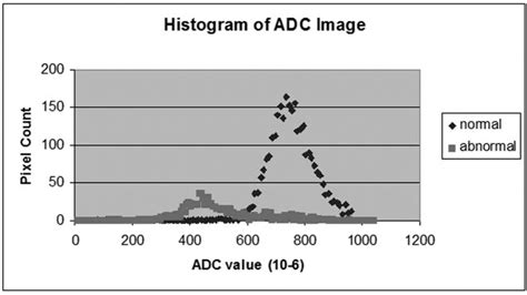 Histogram Of Adc Values In Both Normal Contralateral Brain And A Region Download Scientific