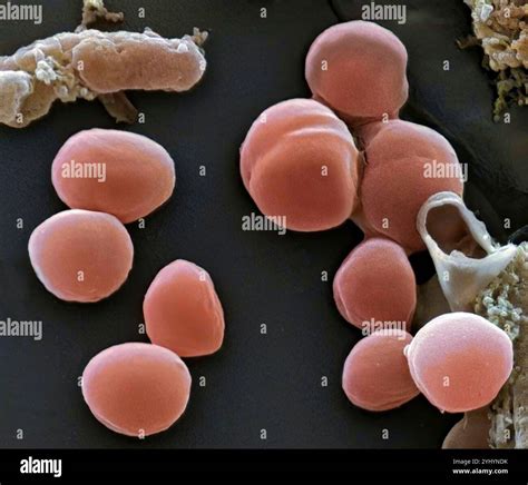 Chlamydia Coloured Scanning Electron Micrograph Sem Of A Colony Of