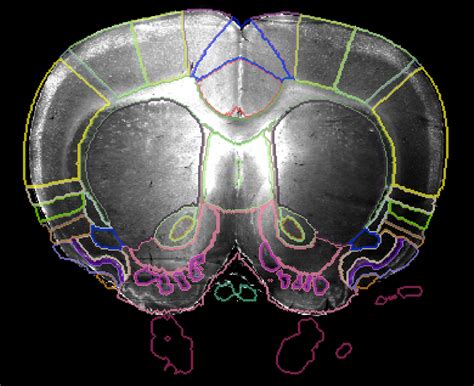 Optimizing A Brainreg Fit Image Analysis Imagesc Forum