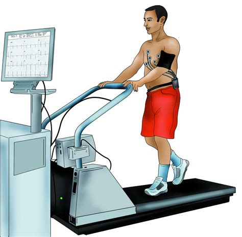 Exercise Stress Test Treadmill Or Bike Stress Test British Heart Valve Society