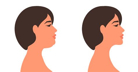 더블 턱 전후 처진 두 번째 턱과 톤 얼굴을 가진 프로필에 있는 여자 벡터 일러스트레이션 흰색 배경에 격리 된 평면 만화 최소한의 디자인 Eps 10 머리에 대한 스톡 벡터