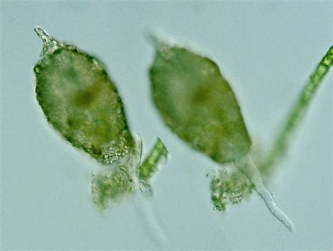 Protist Images Difflugia Elegans