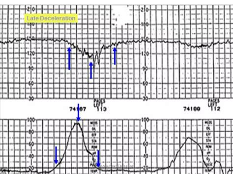 Ctg Patterns Pdf