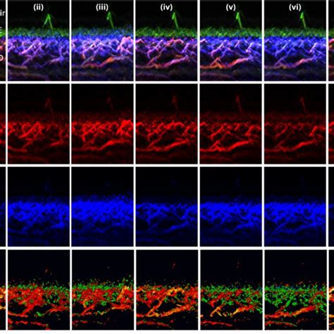 Multispectral Optoacoustic Mesoscopic Imaging Of Forearm During Venous